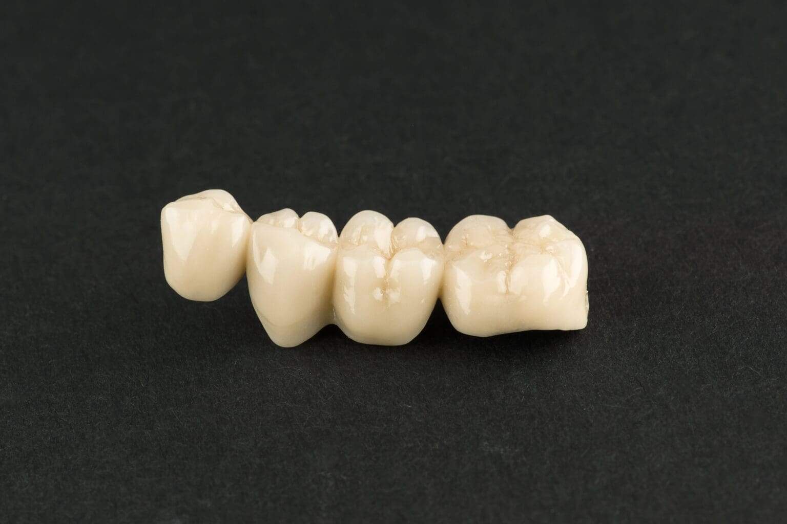 Dental Bridge vs Partial Denture: Which One is Right for You ...